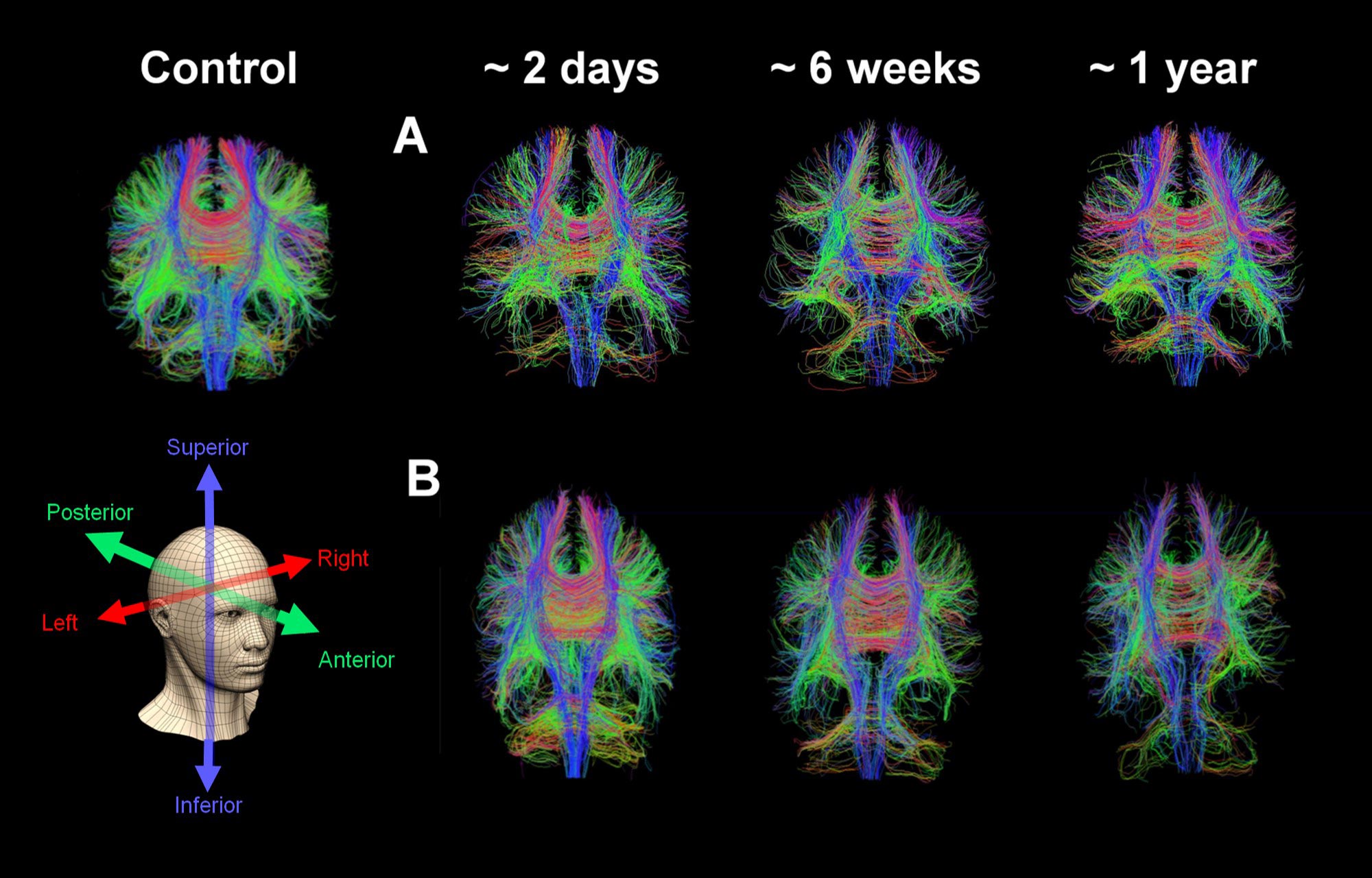 האם זעזוע המוח שלך מסתיר משהו? MRI מתקדם זה יכול היה לדעת - Twoday טודיי